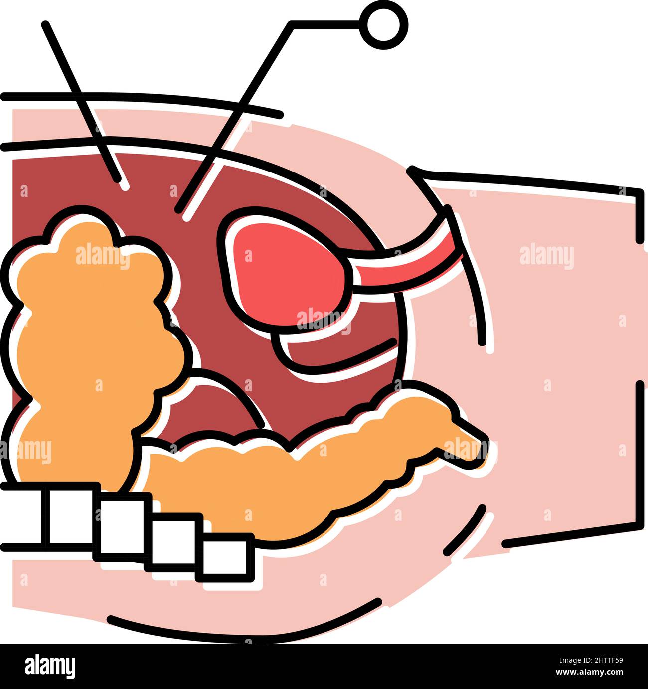 operation process bariatric color icon vector illustration Stock Vector ...
