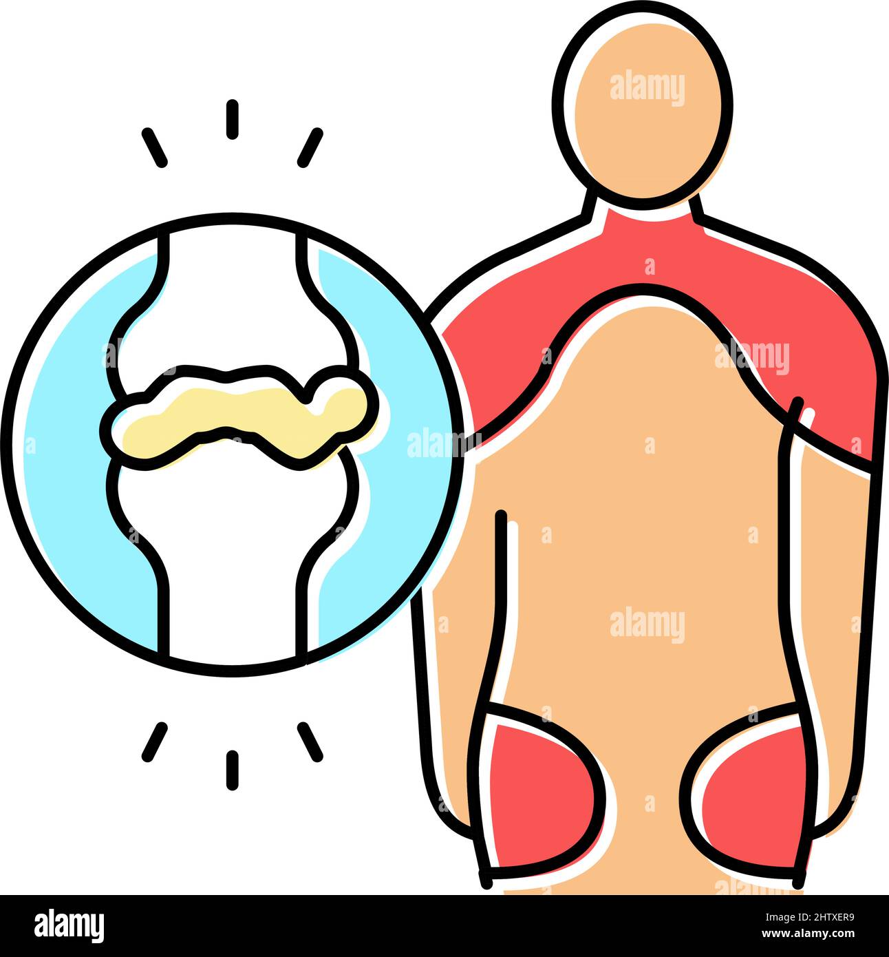 polymyalgia rheumatica color icon vector illustration Stock Vector ...