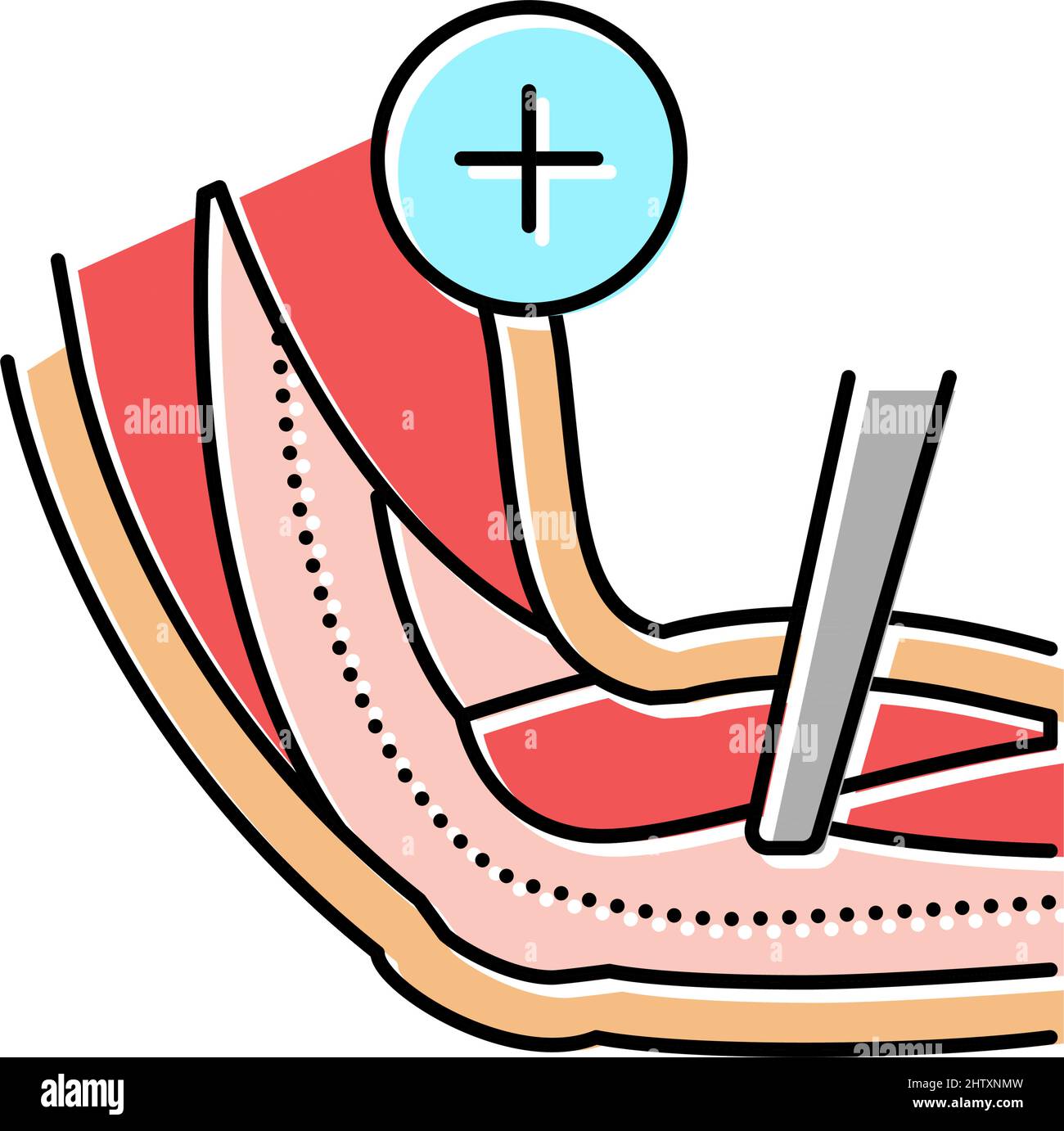 Nerve Tissue Seer Training