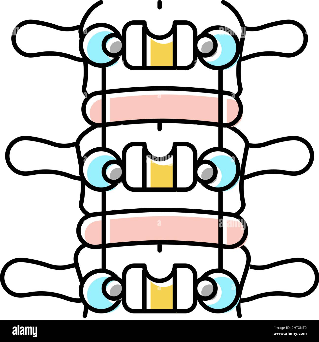 spinal fusion color icon vector illustration Stock Vector Image & Art ...
