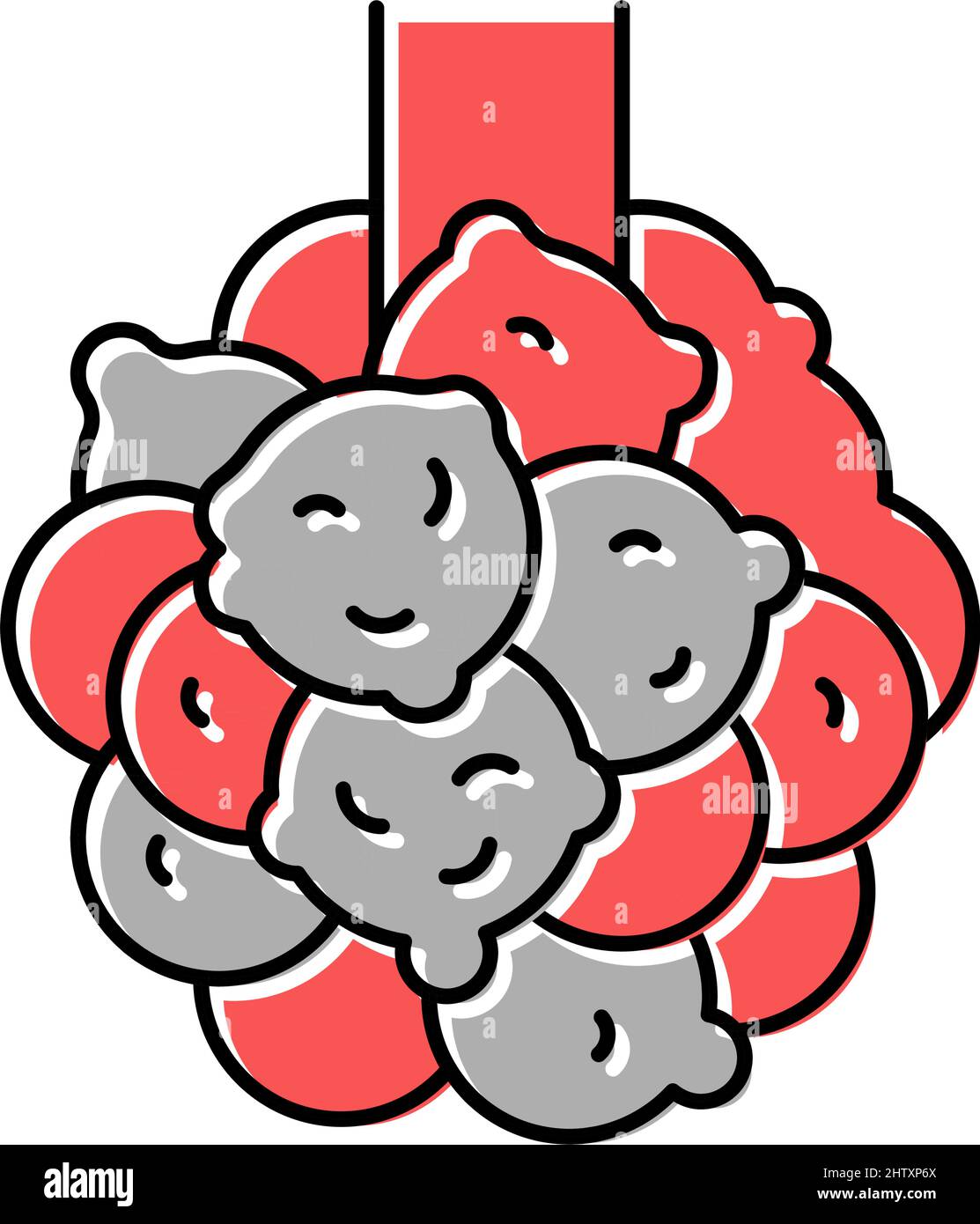 Bronchiectasis x ray hi-res stock photography and images - Alamy