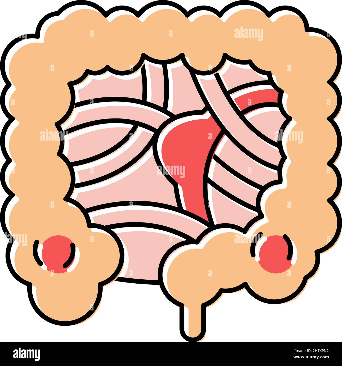 intestinal obstruction disease color icon vector illustration Stock ...