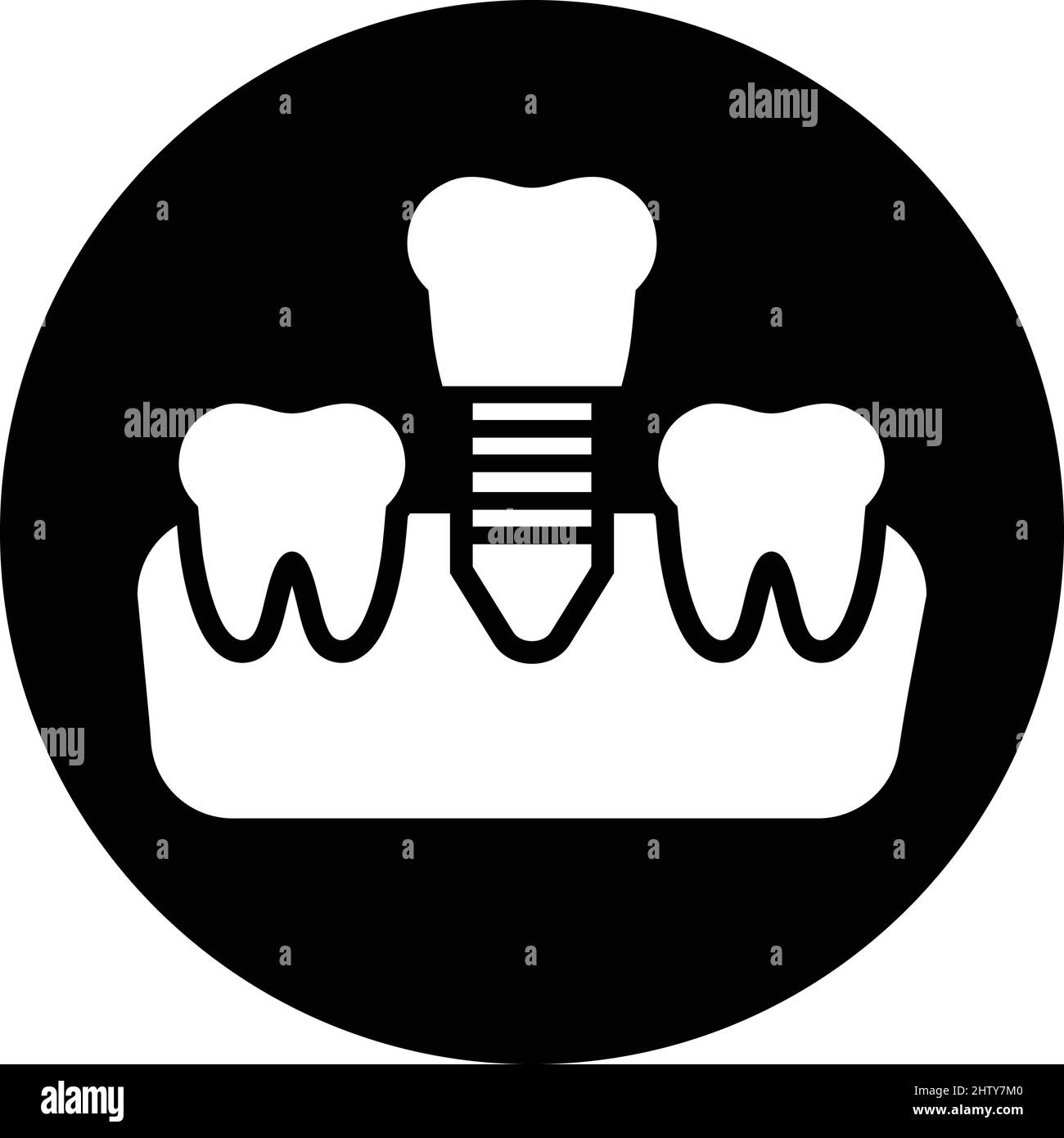 Dental screw, tooth implanting icon - Perfect use for designing and ...