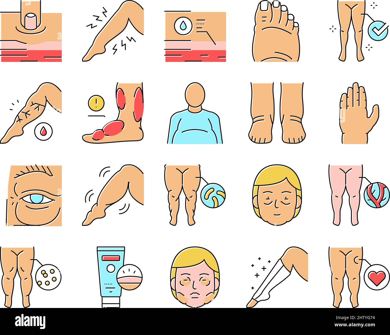 Edema Disease Symptom Collection Icons Set Vector Stock Vector Image ...