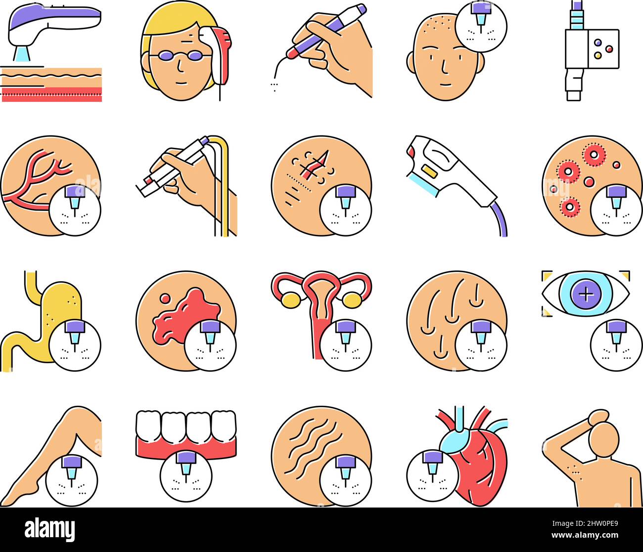 Laser Therapy Service Collection Icons Set Vector Stock Vector Image ...