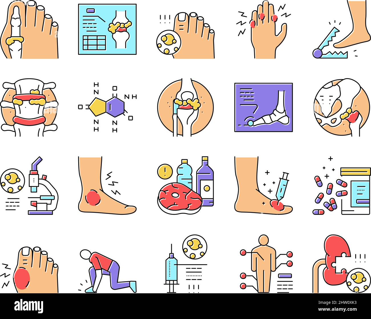 Gout Health Disease Collection Icons Set Vector Stock Vector Image & Art - Alamy
