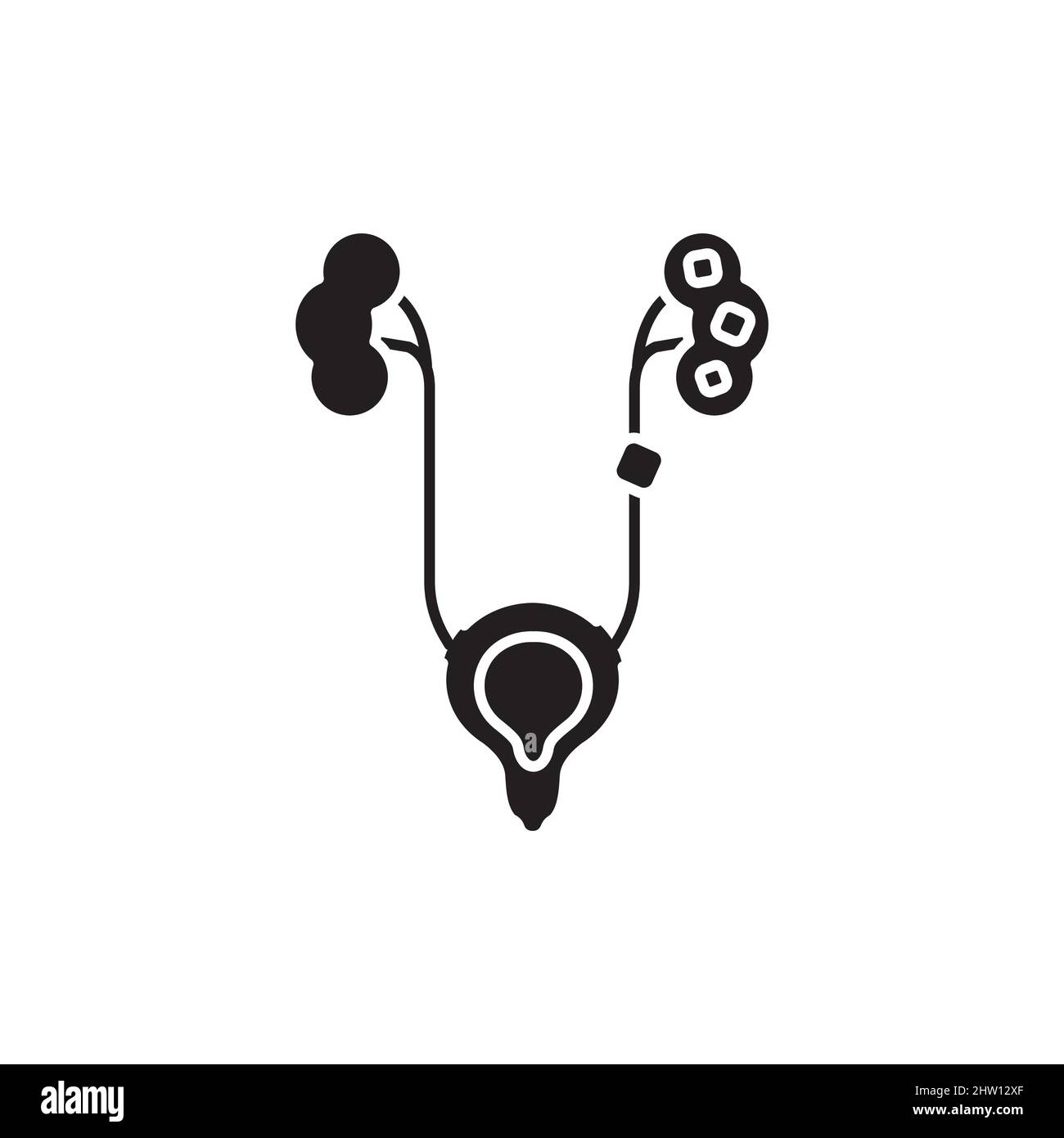 Urolithiasis disease color line icon. Pictogram for web page, mobile ...