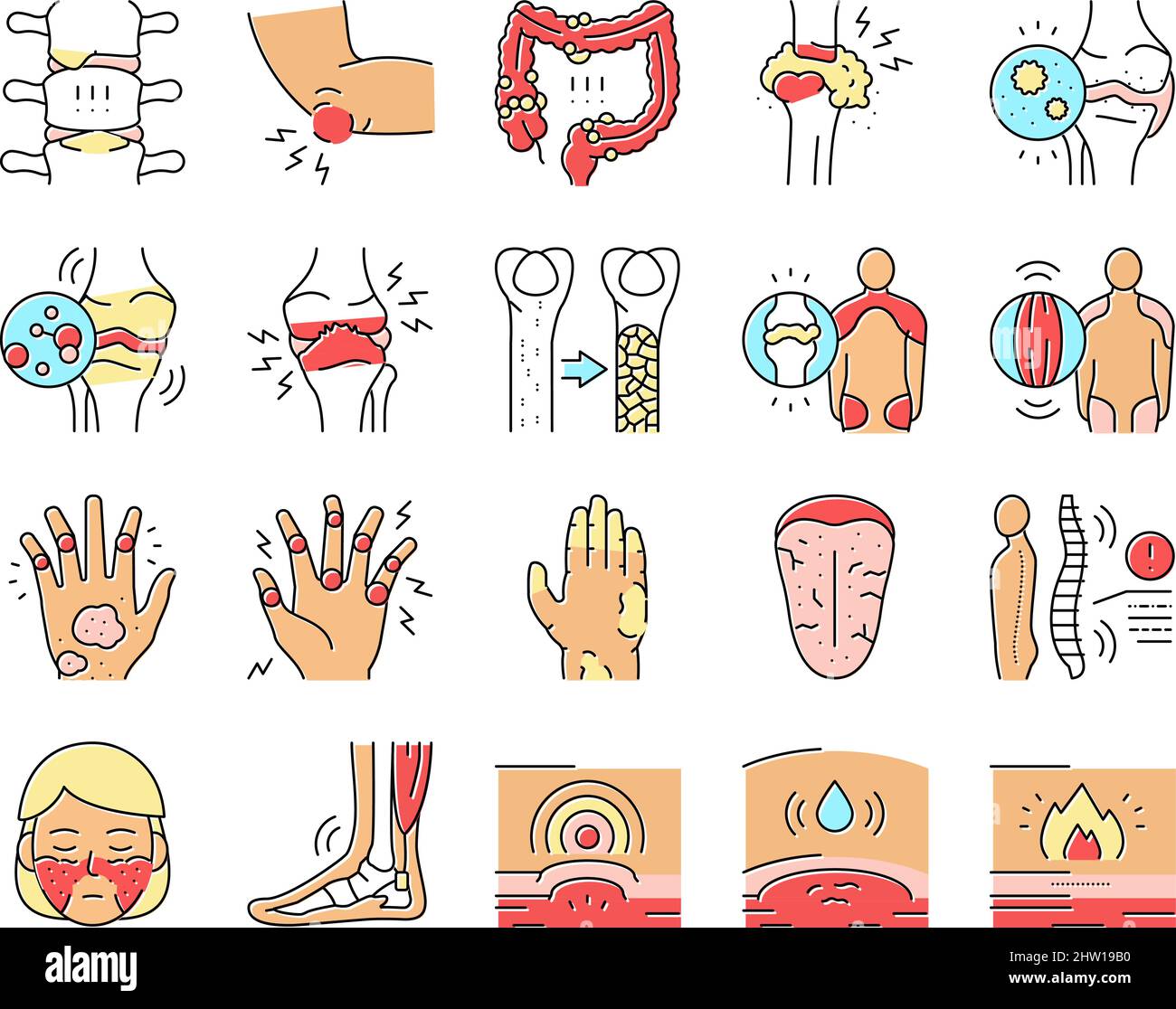Rheumatology Disease Problem Icons Set Vector Stock Vector Image & Art ...