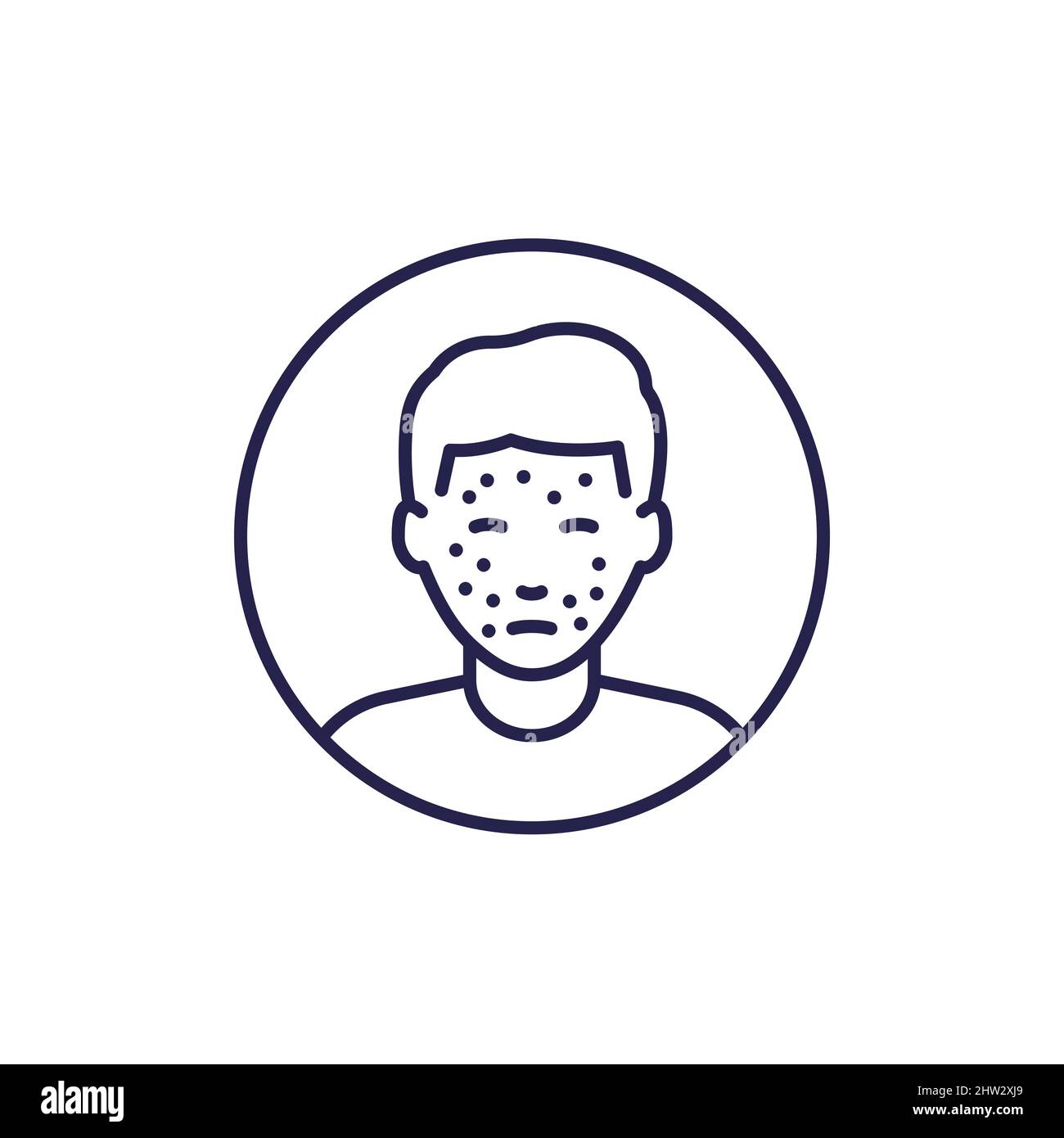 acne icon, skin problem, rash line vector Stock Vector Image & Art - Alamy