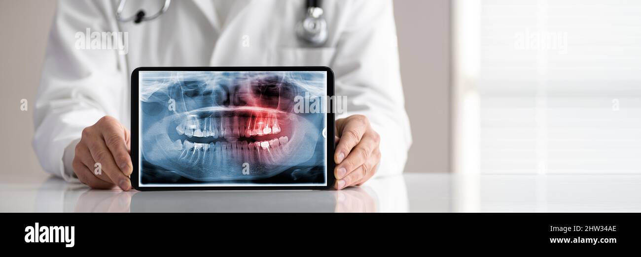 Digital hand hygiene scanner hi-res stock photography and images - Alamy