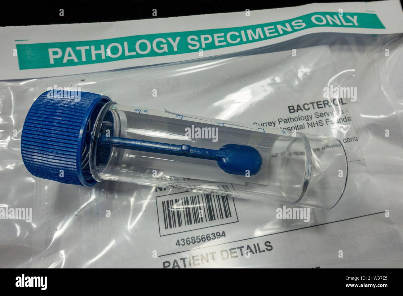 Medical sample container with small scoop/spoon for taking stool ...