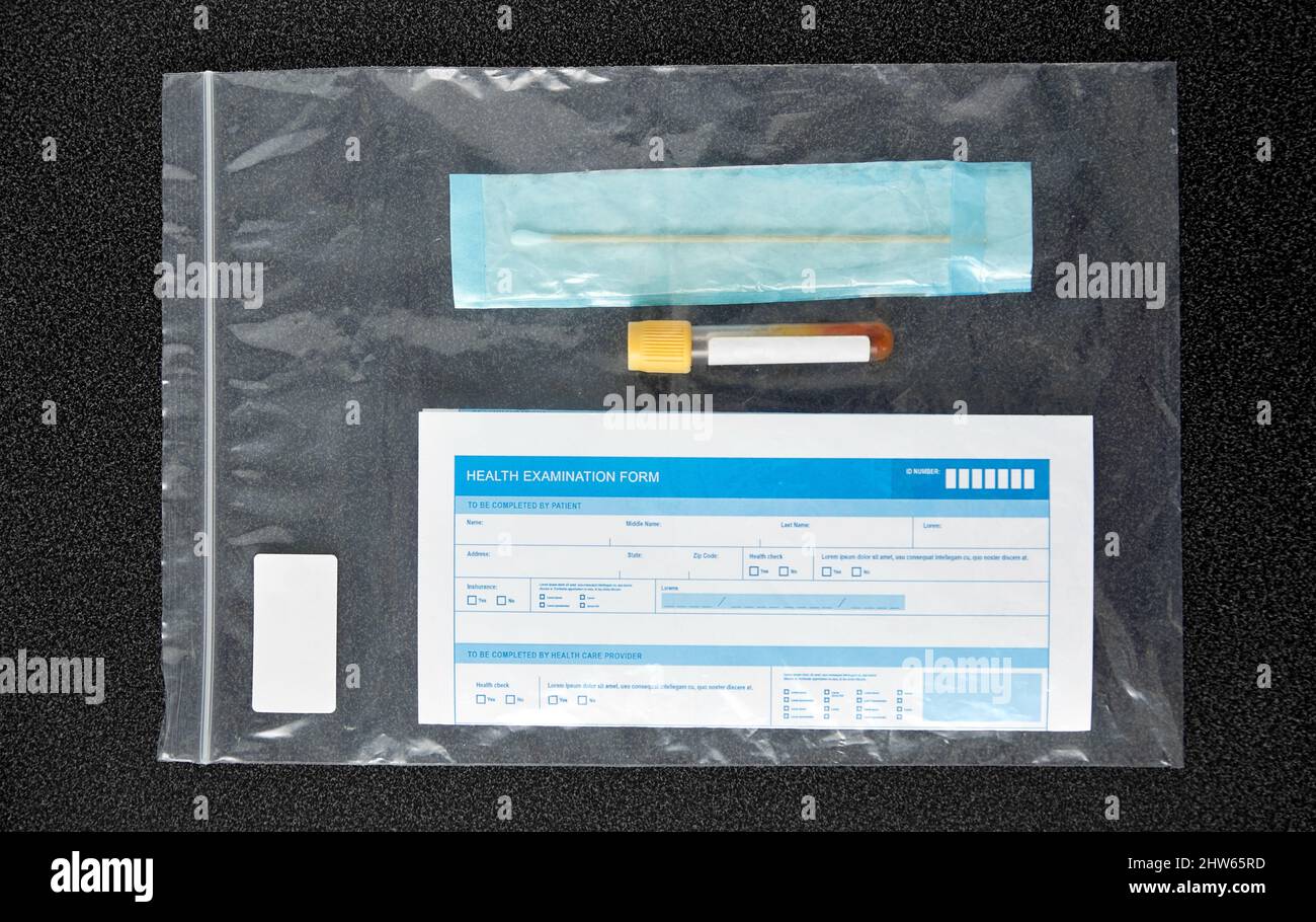 beaker with test, cotton swab and medical report Stock Photo - Alamy