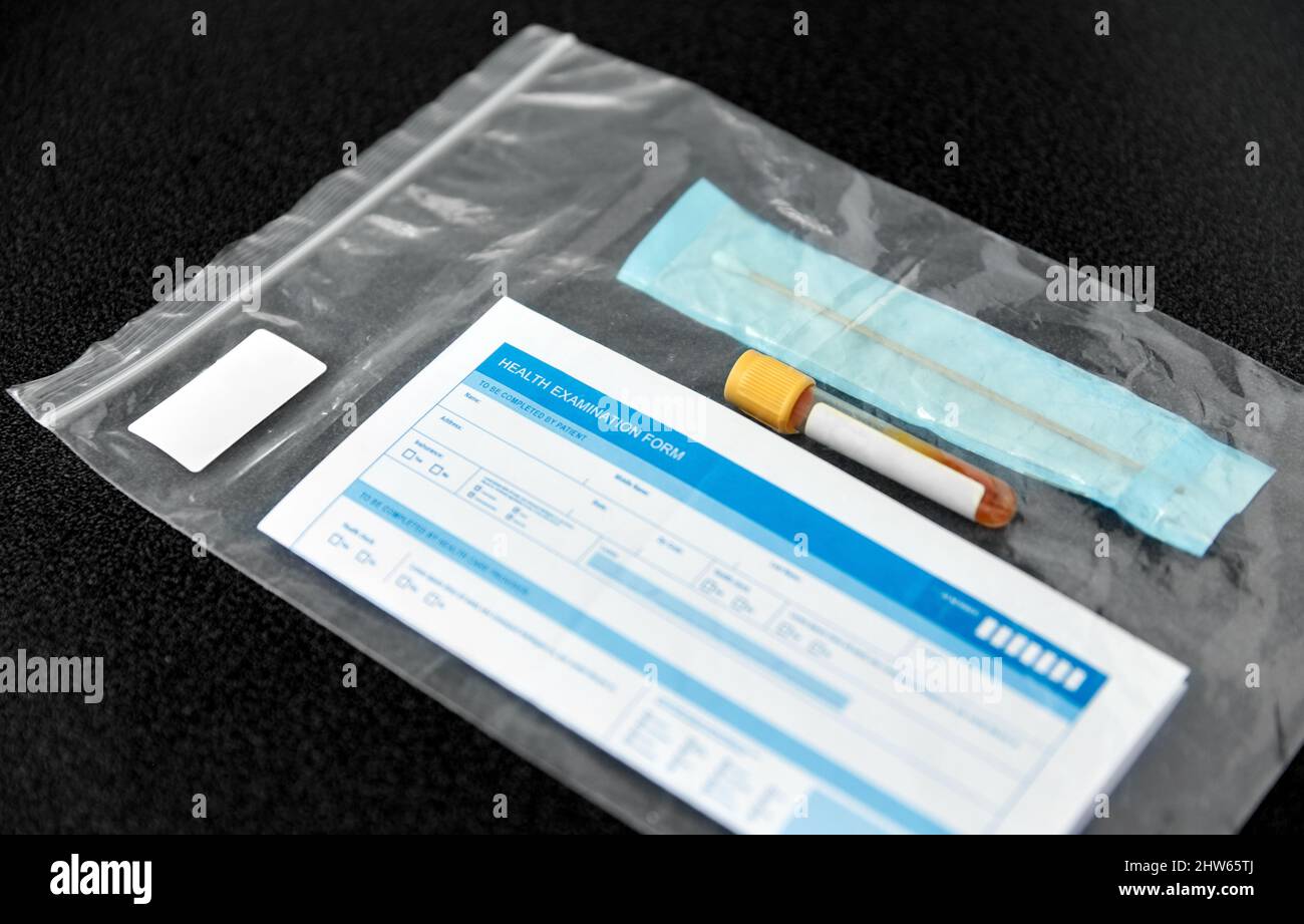 beaker with test, cotton swab and medical report Stock Photo - Alamy