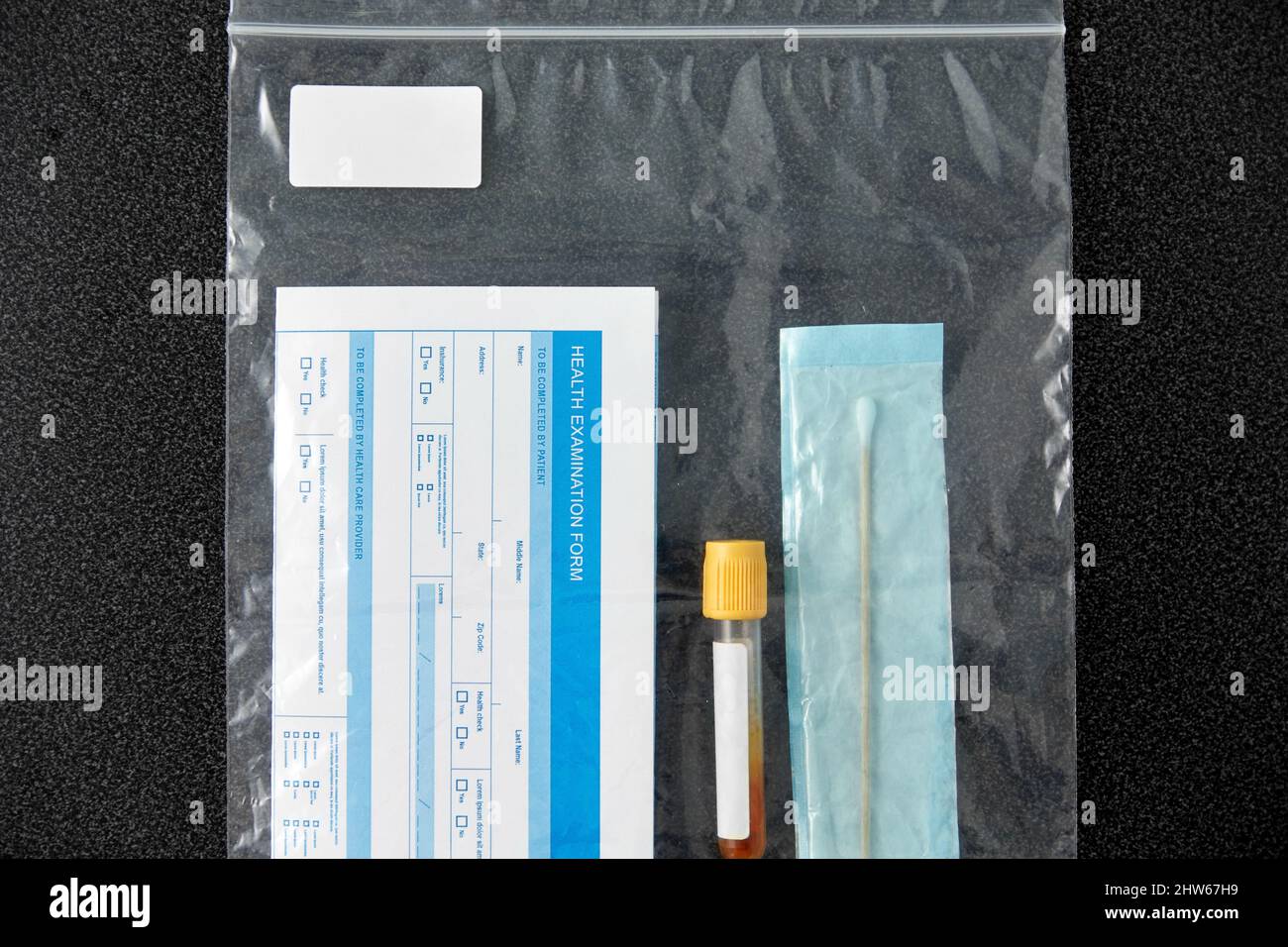 beaker with test, cotton swab and medical report Stock Photo - Alamy