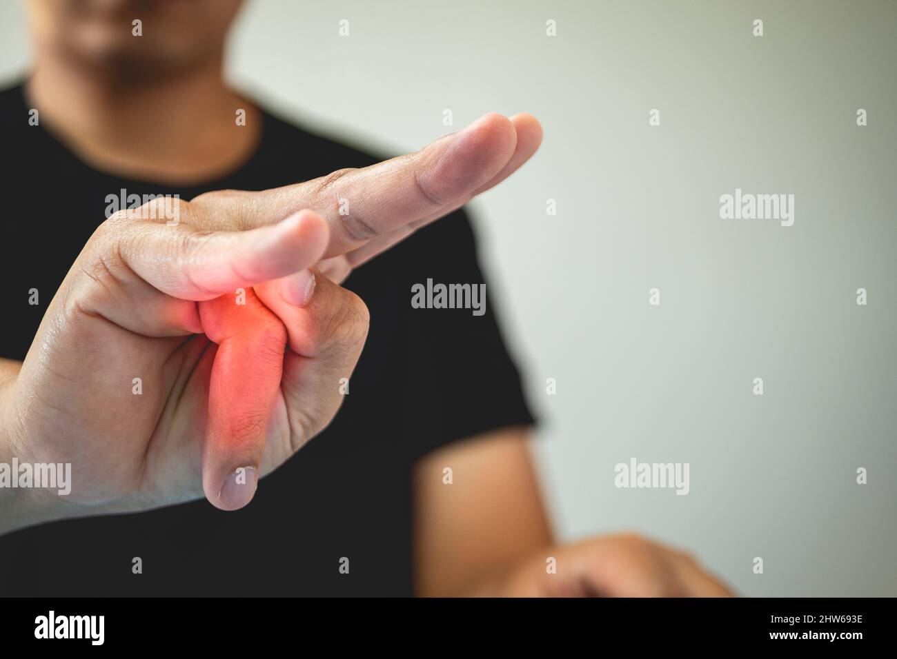 Ring finger injury hi-res stock photography and images - Alamy