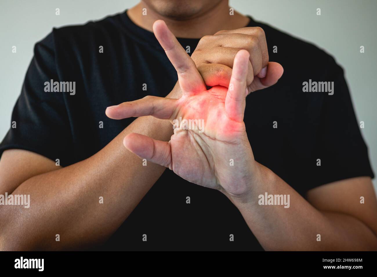 Ring finger injury hi-res stock photography and images - Alamy