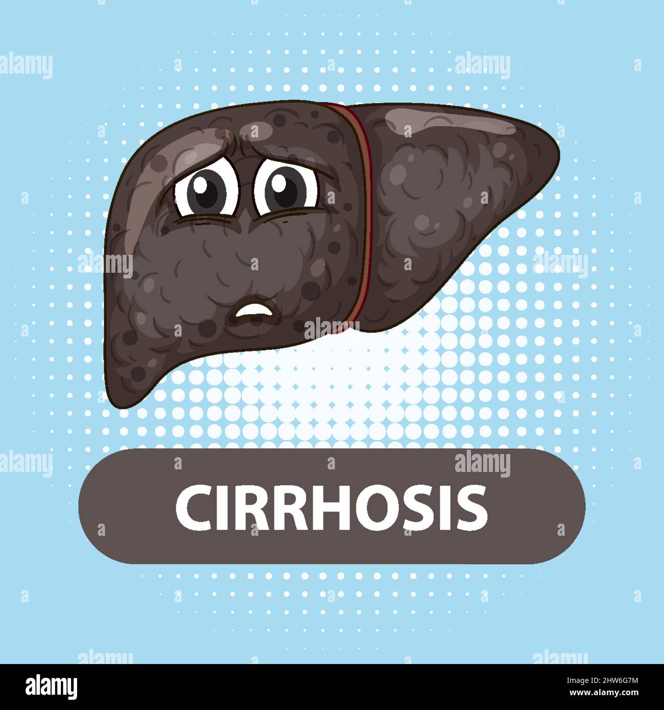 Cirrhosis liver cartoon character illustration Stock Vector Image & Art ...