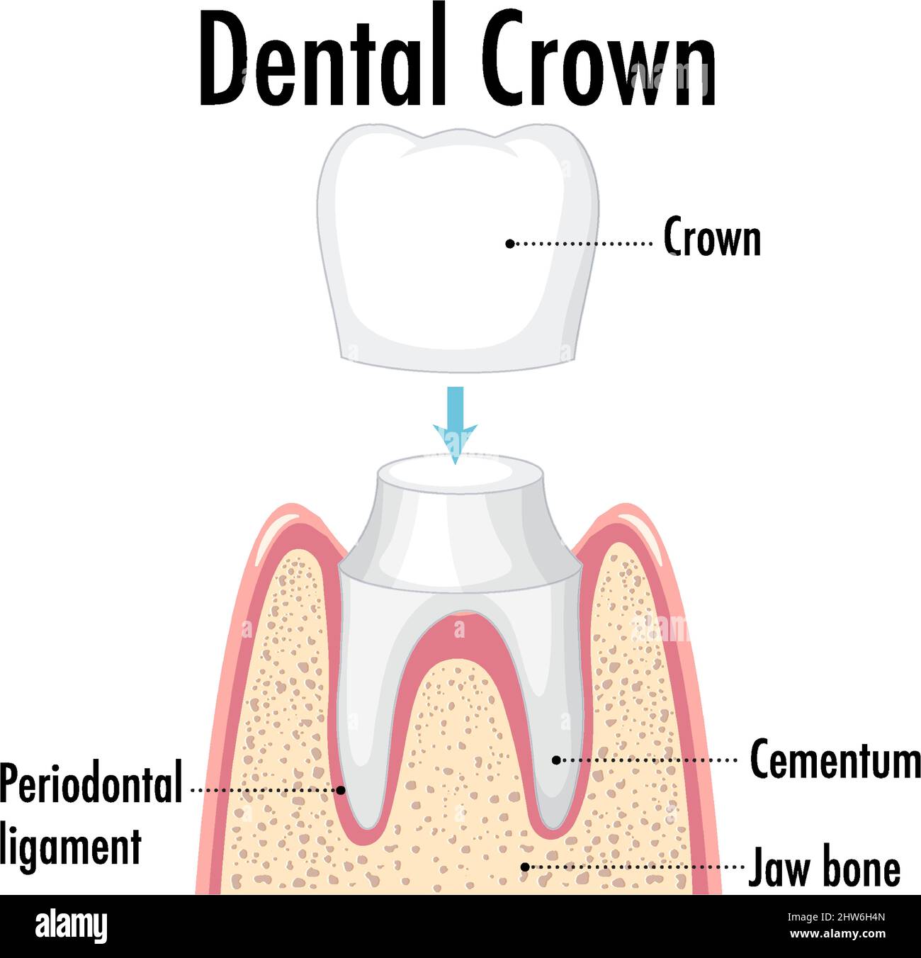 Infographic of human in dental crown illustration Stock Vector Image ...