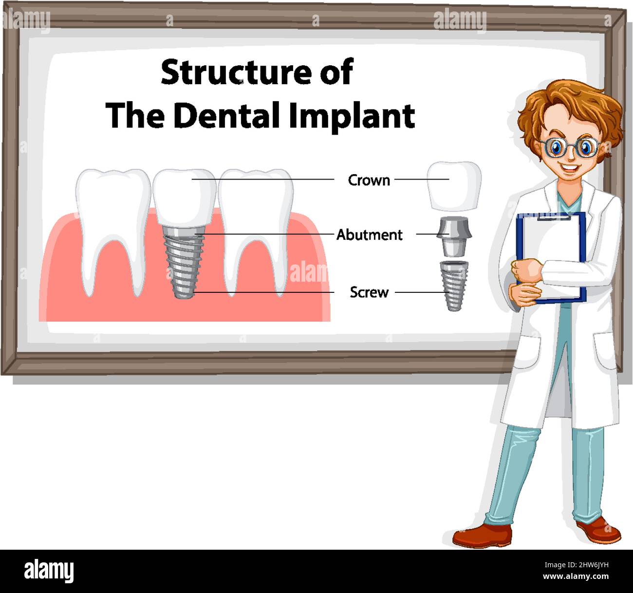 Infographic of human in structure of the dental implant illustration ...