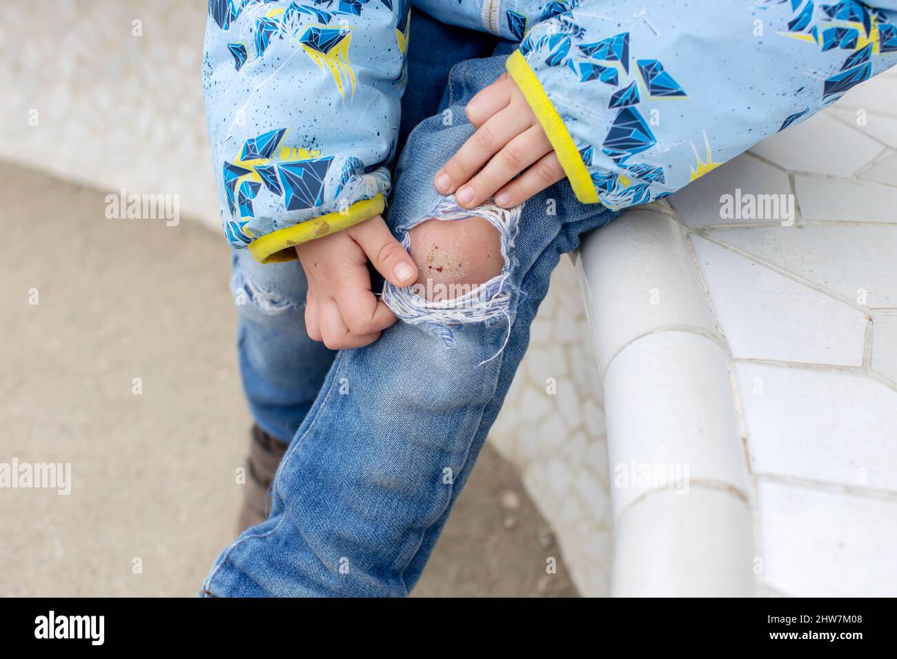 Little boy, showing wounded knee from a fall, sitting on a bench in the ...