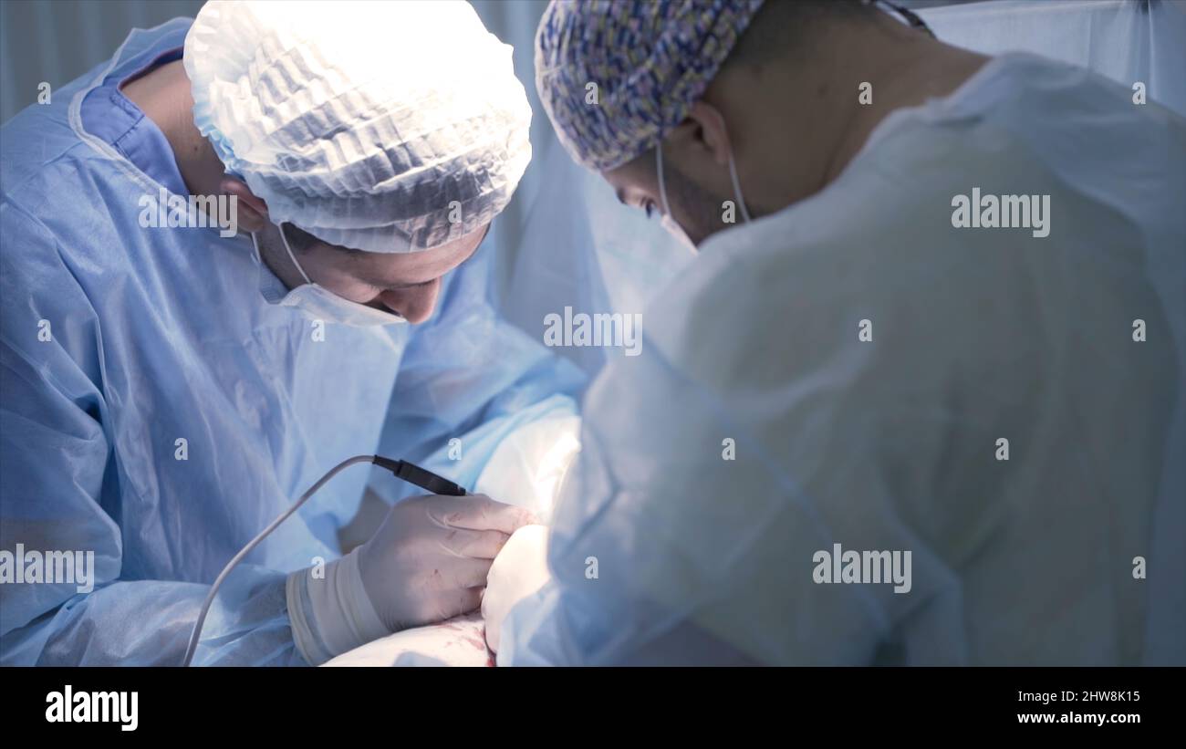 Surgeons operate on person under anesthesia. Action. Two professional ...