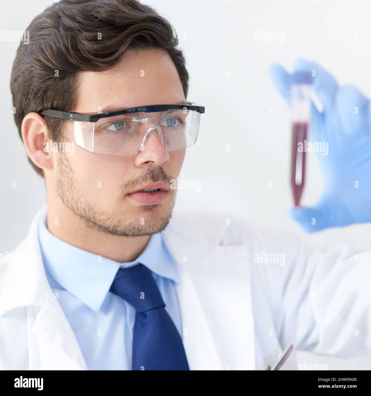 Identifying microorganisms that are causing infection. Cropped shot of ...