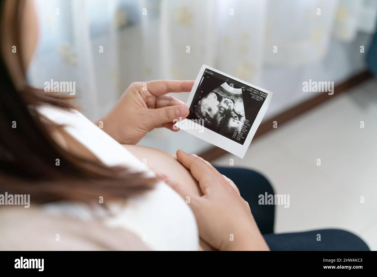 Close up of cute pregnant belly and x ray ultrasound scan of baby, x ...