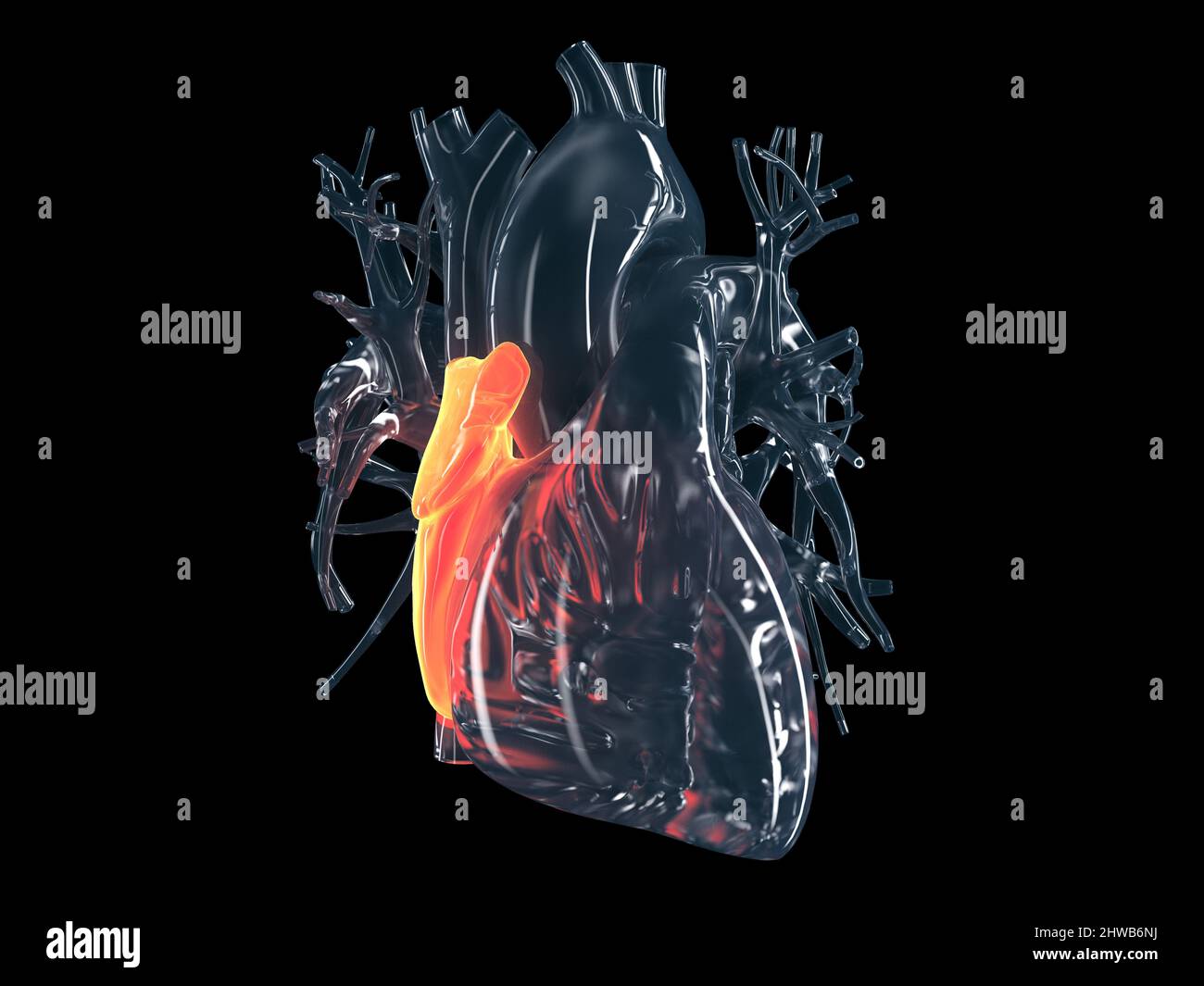 Right atrium hi-res stock photography and images - Alamy