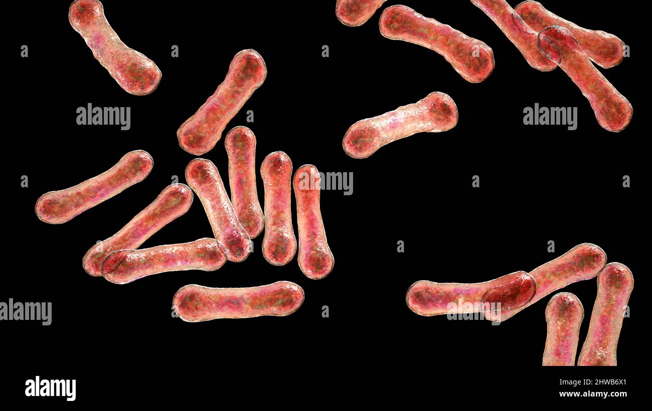 Corynebacterium diphtheriae, illustration Stock Photo - Alamy
