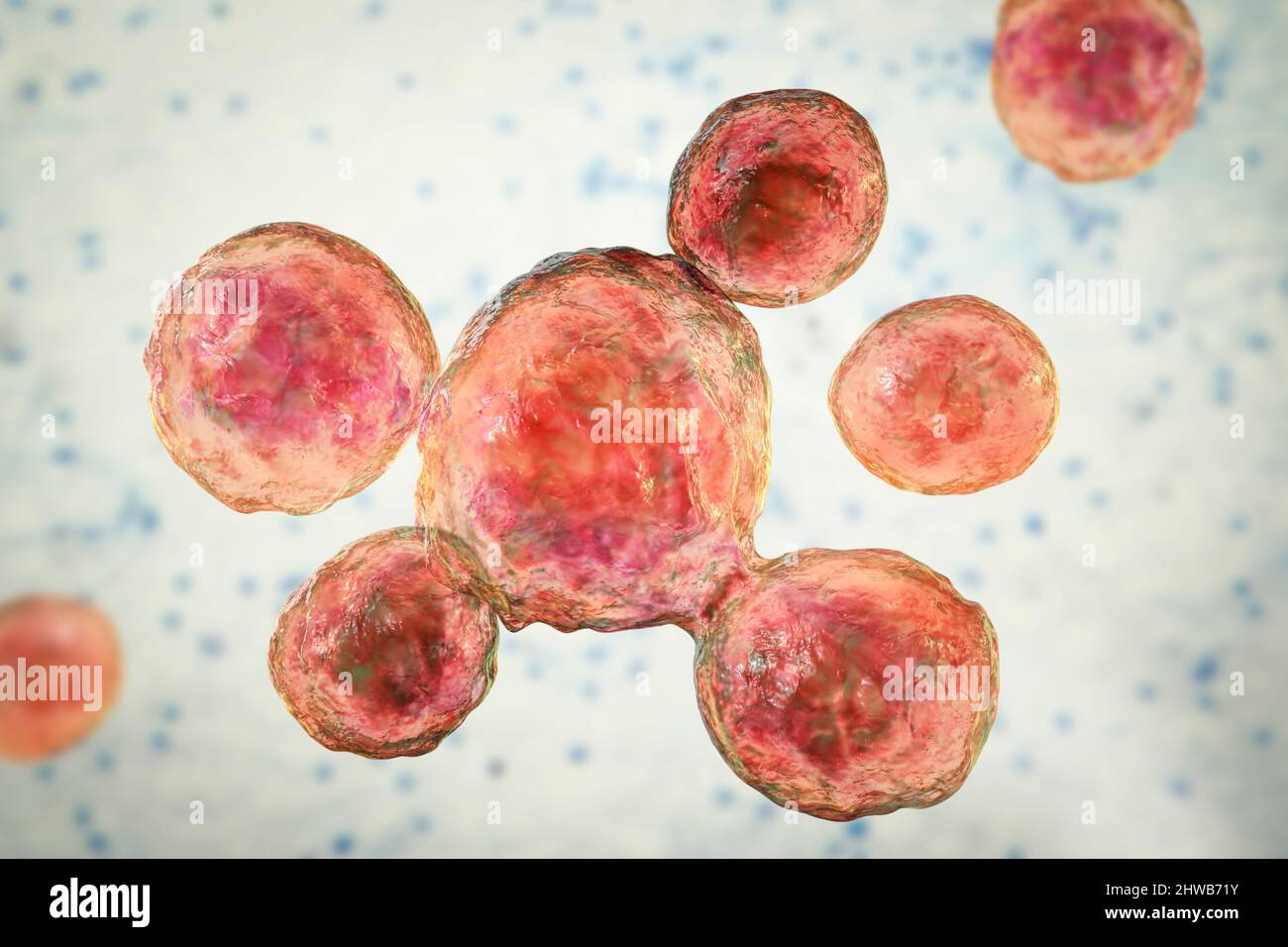 Paracoccidioidomycosis hi-res stock photography and images - Alamy