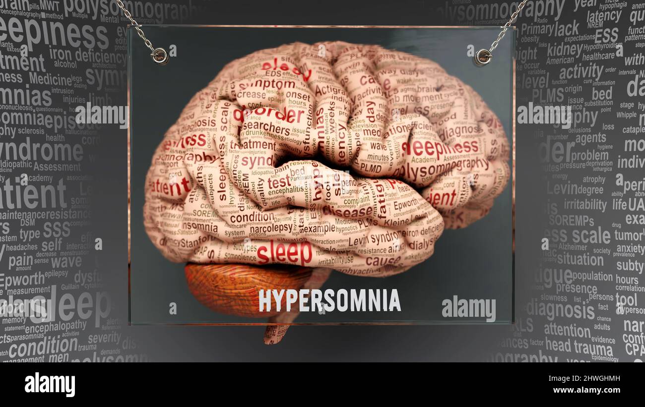 Hypersomnia anatomy - its causes and effects projected on a human brain ...