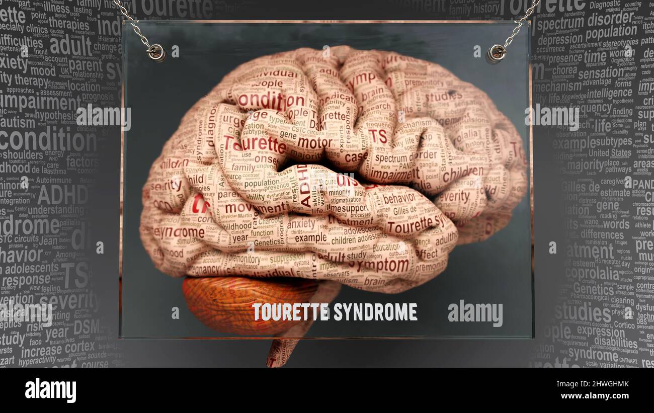 Tourette syndrome anatomy - its causes and effects projected on a human ...