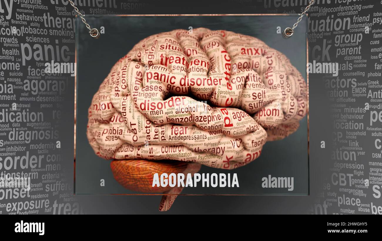 Agoraphobia anatomy - its causes and effects projected on a human brain ...
