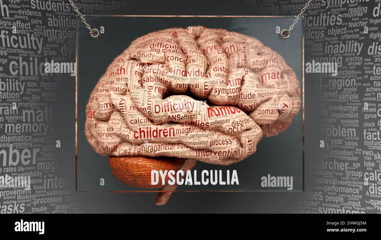 Dyscalculia anatomy - its causes and effects projected on a human brain ...