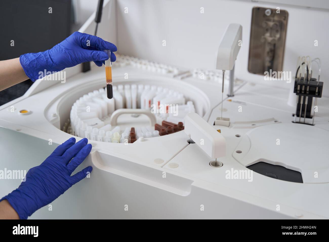 Doctor making blood analysis hi-res stock photography and images - Alamy