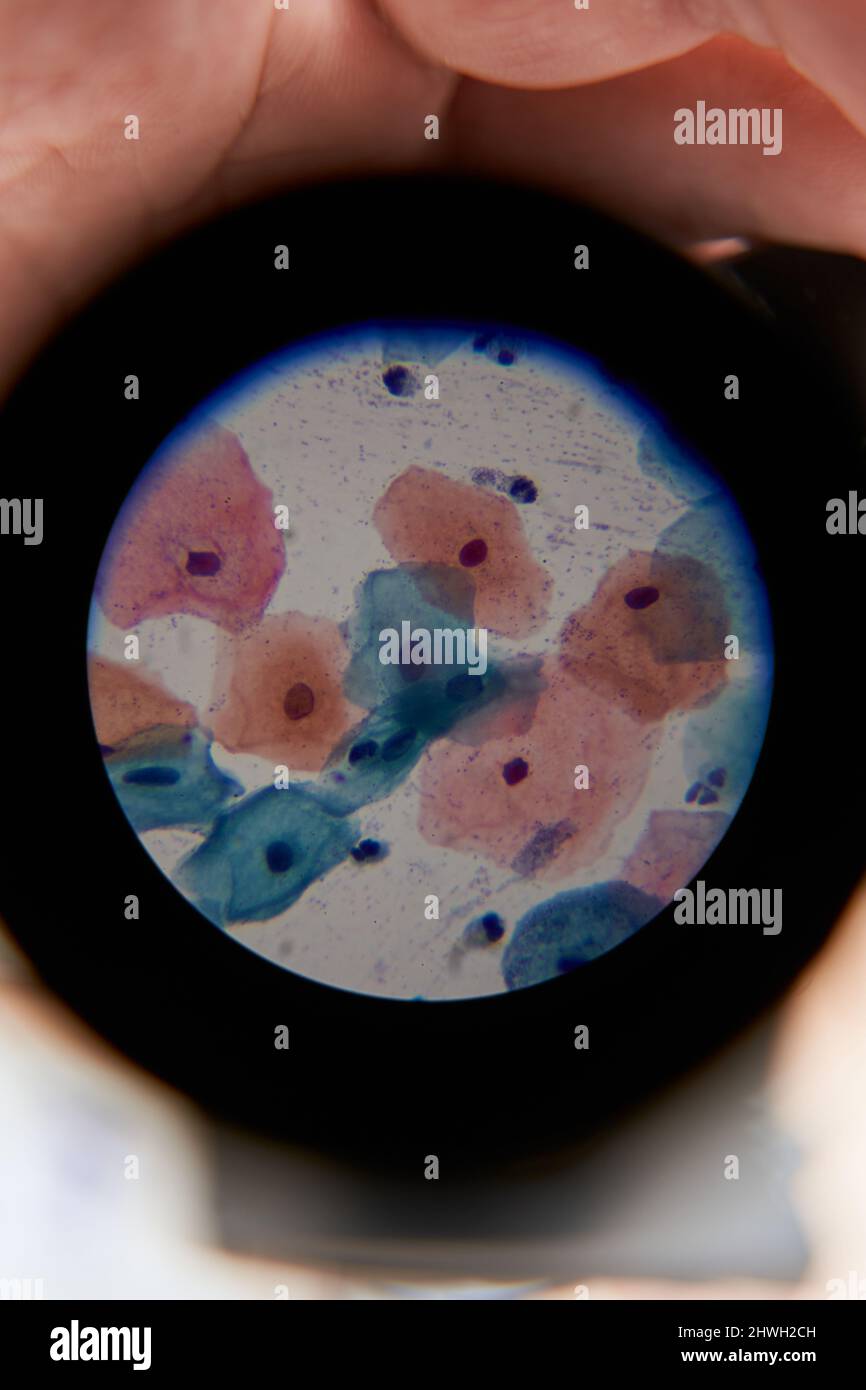 Color image in microscope of microorganisms in the lab Stock Photo - Alamy