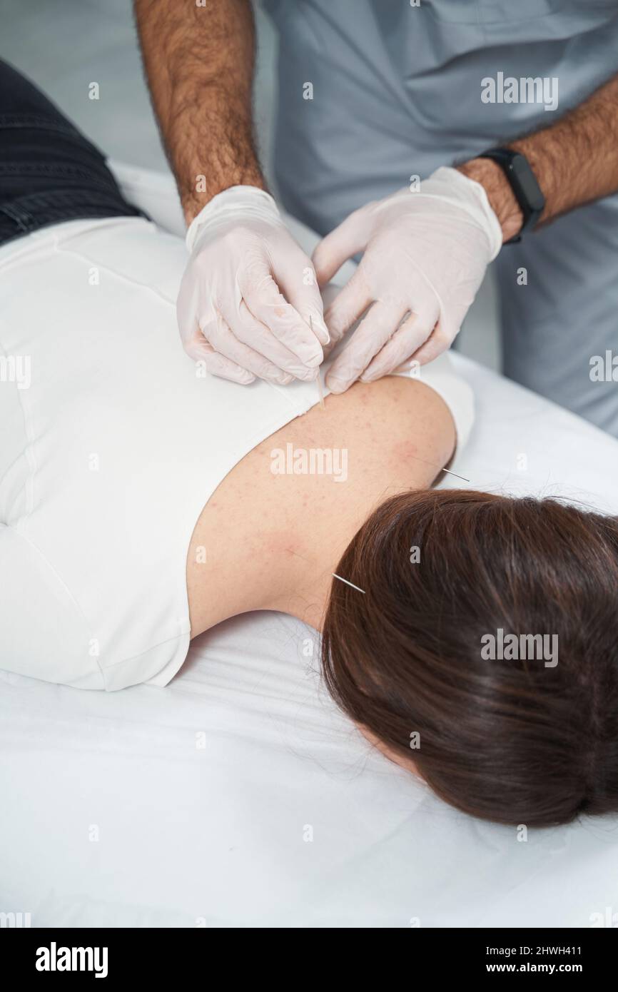 Lady on acupuncture session to relax muscles Stock Photo - Alamy