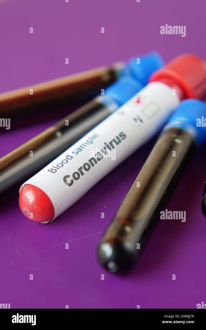 close up of corona virus blood test tube on table Stock Photo - Alamy