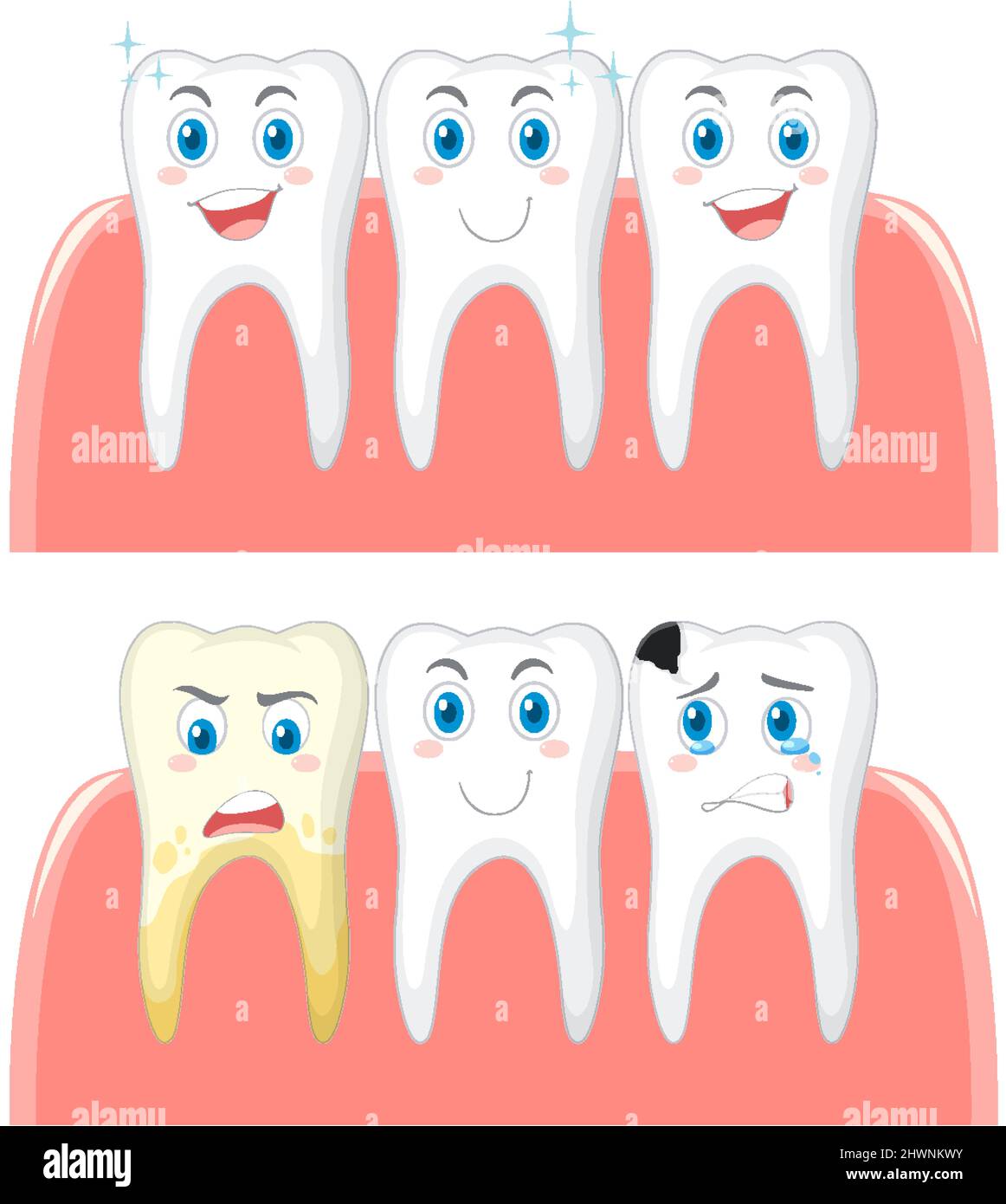 Set of strong teeth and tooth decay on white background illustration ...