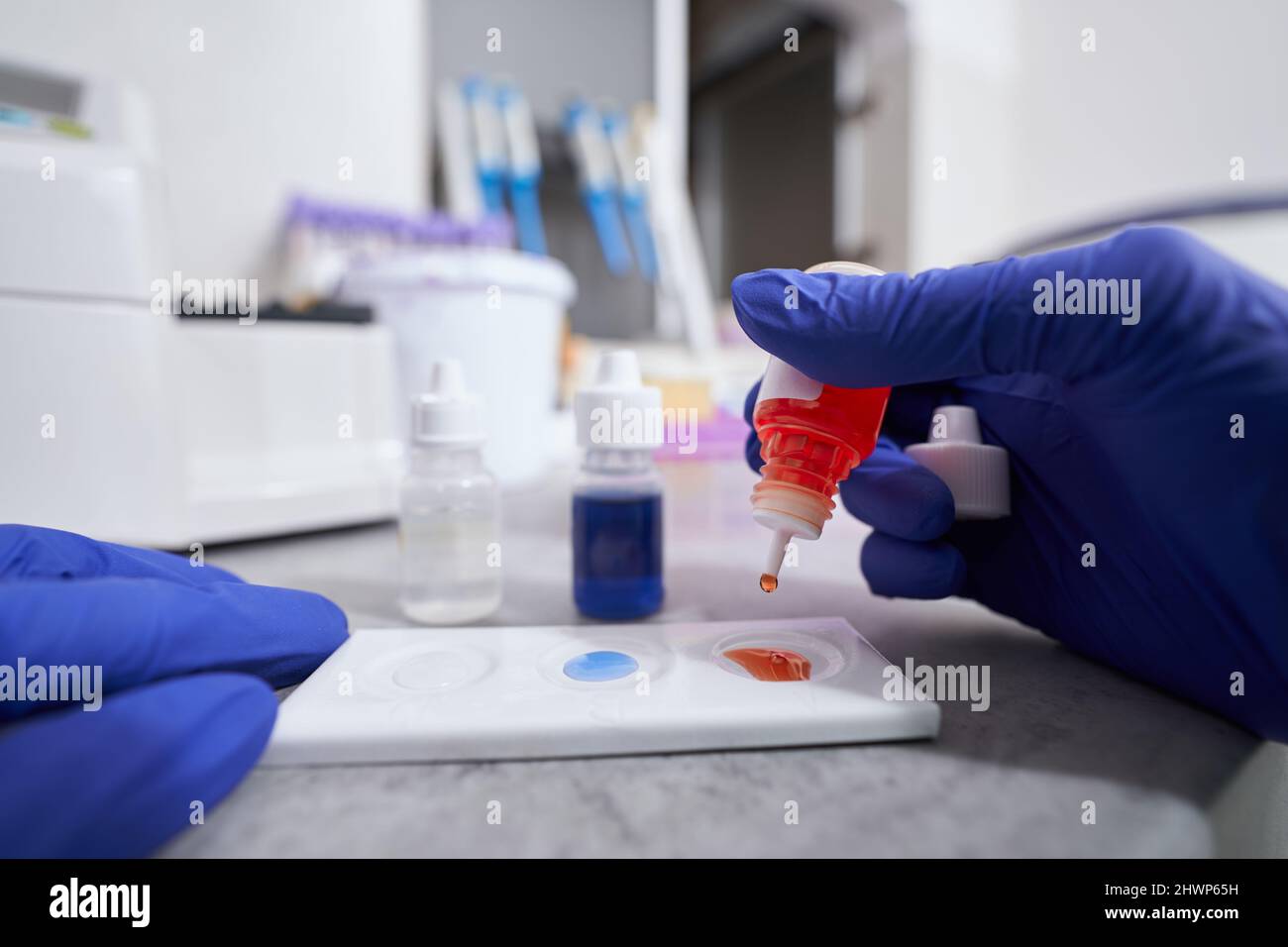 Close-up photo of nurse making test in laboratory Stock Photo - Alamy