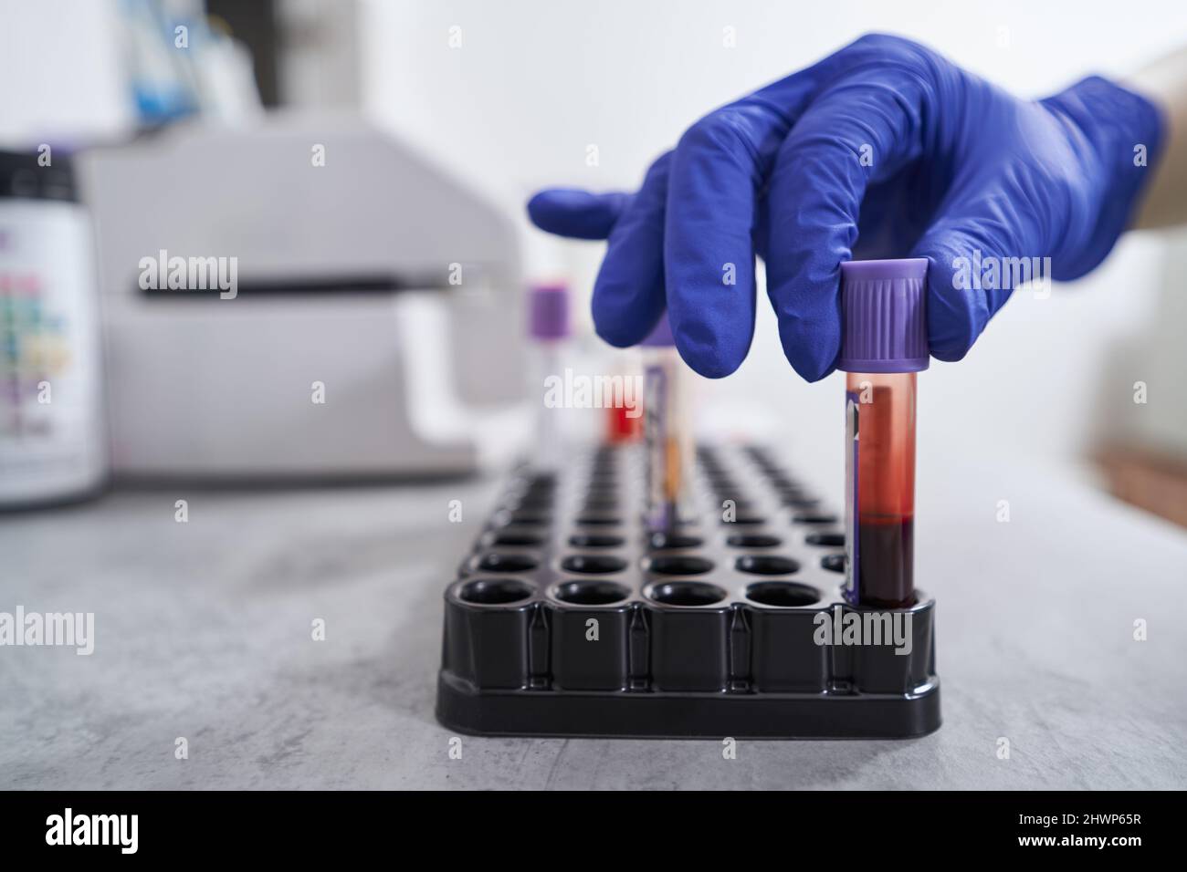 Close-up photo of work in medical laboratory Stock Photo - Alamy