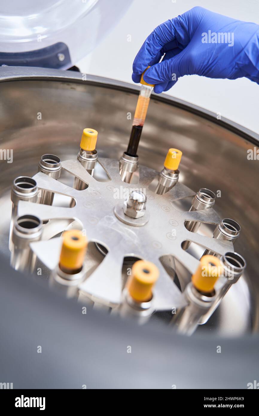 Nurse doing medical research with centrifuge in hospital Stock Photo ...