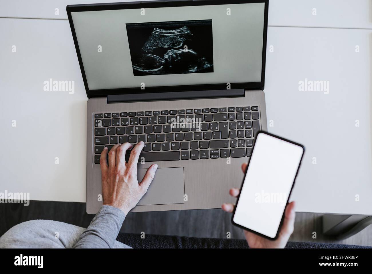 Ultrasound baby on mobile phone hi-res stock photography and images - Alamy