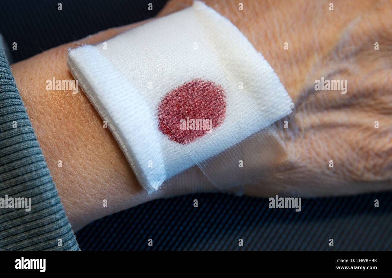 Blood stained bandage hi-res stock photography and images - Alamy