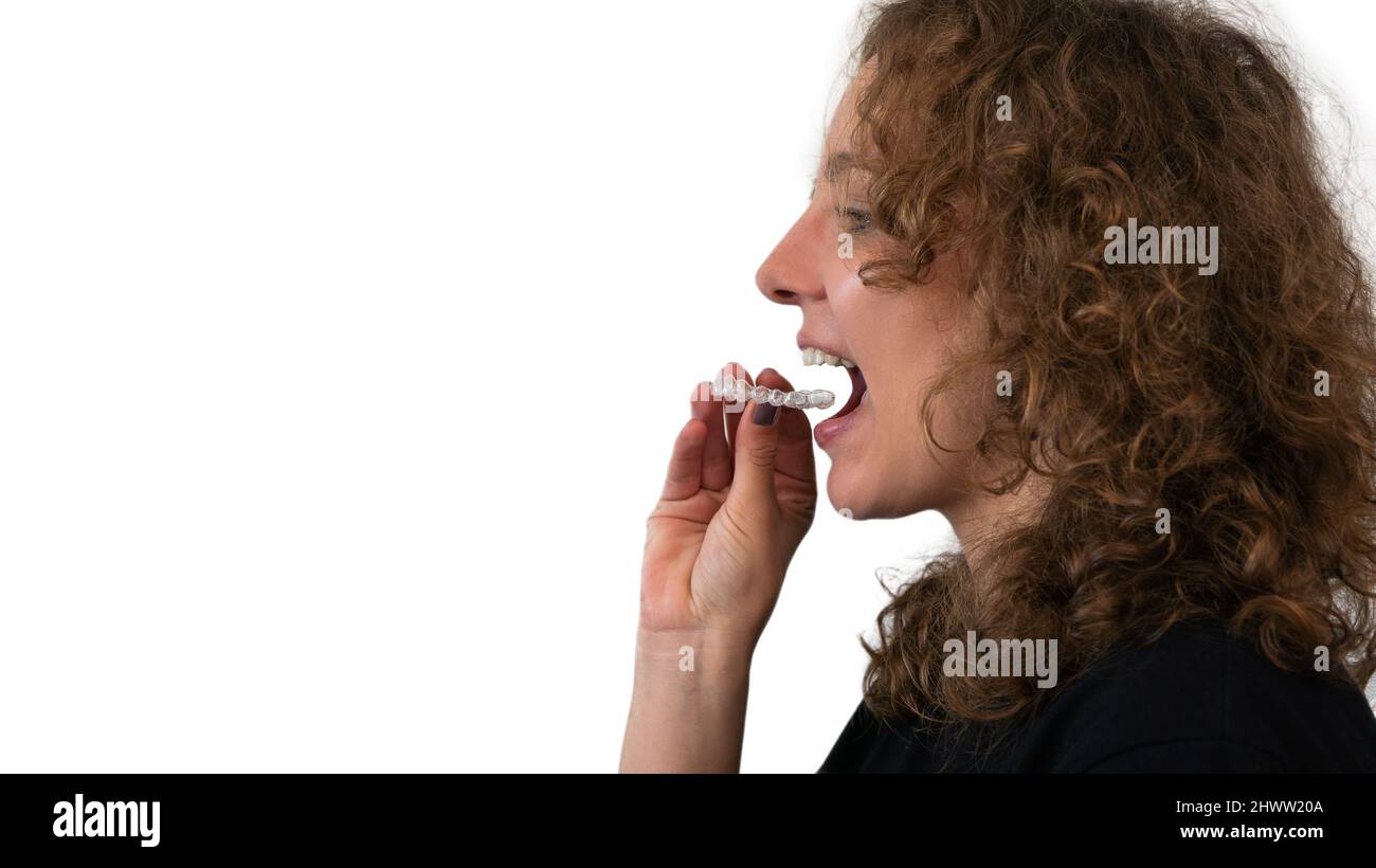 Caucasian young woman adjusting and placing an invisible silicone ...