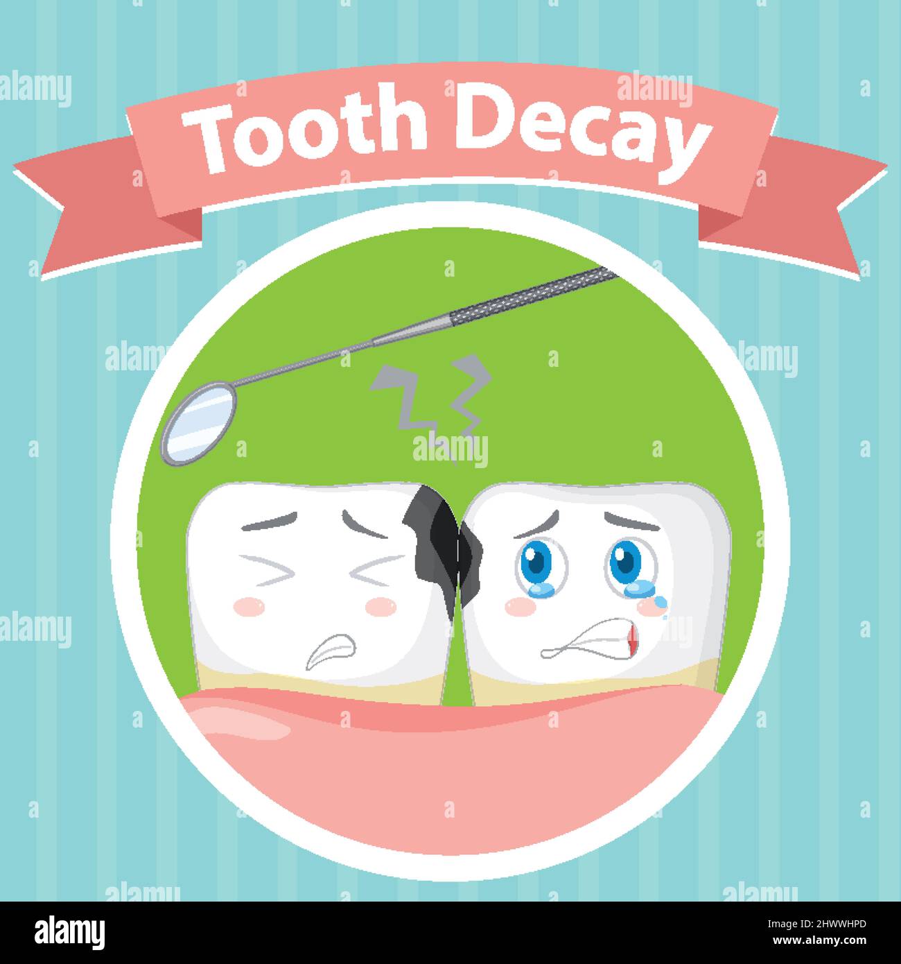 Dental healthy a big tooth decay poster illustration Stock Vector Image ...