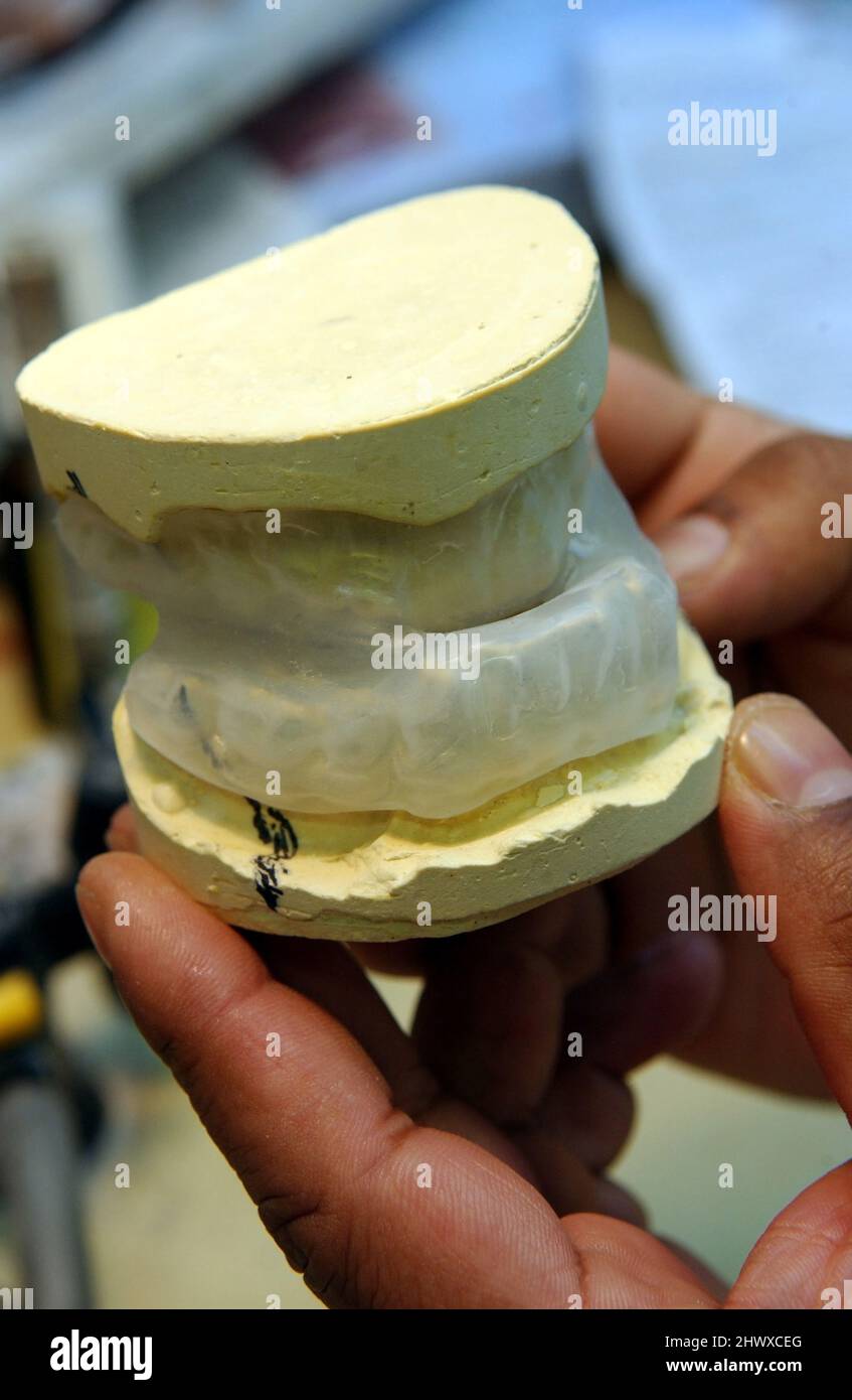 A dental silencer which helps patient who have severe problems with ...