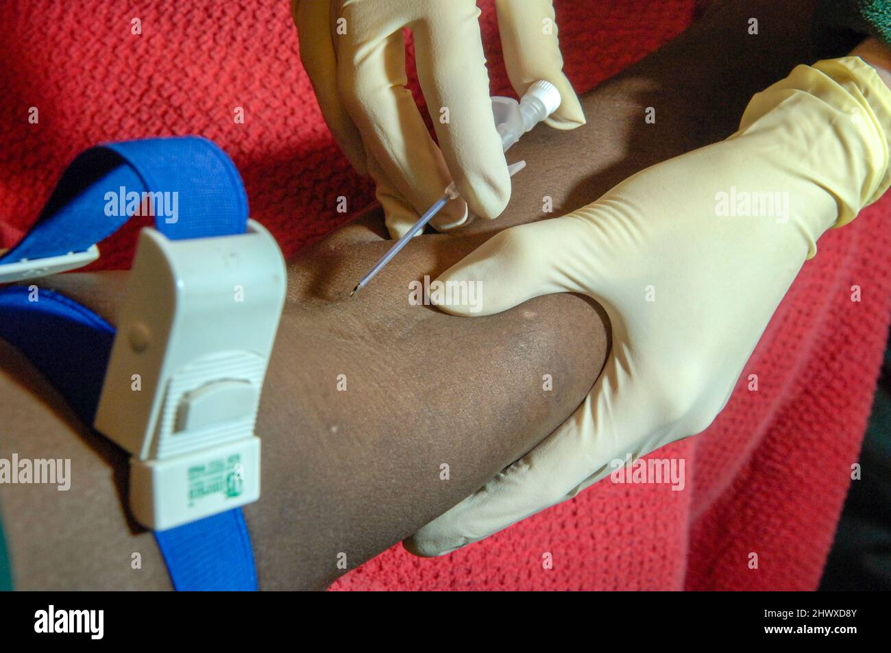Paramedic inserting an intravenous catheter into a patient's arm Stock ...