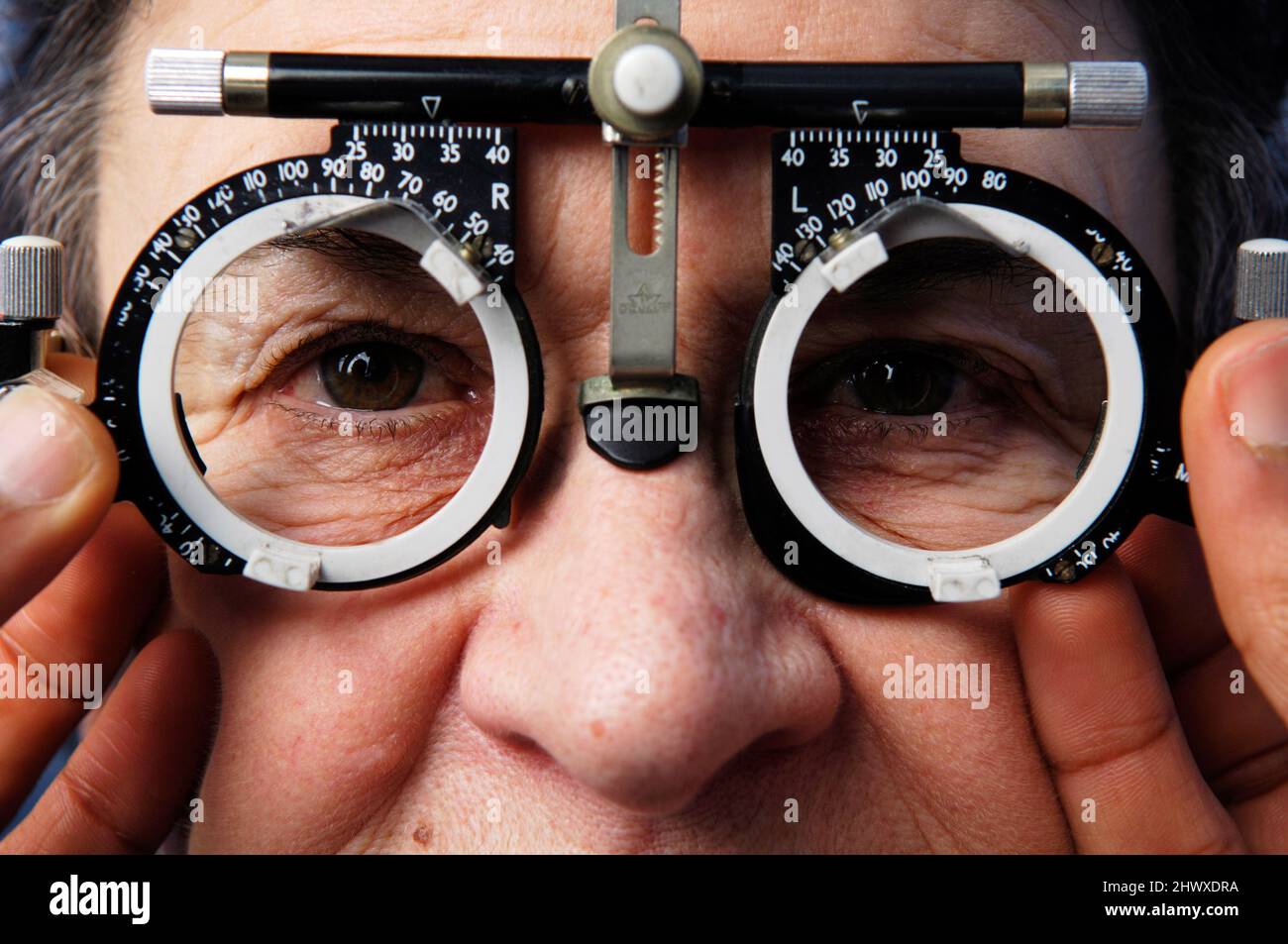 A trial frame is used to find the best lens for a patient with a ...