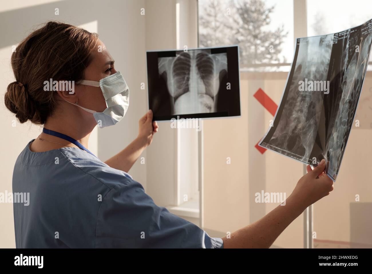 Young nurse or radiologist comparing two x-ray images of human thorax ...